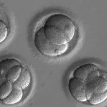 In Vitro Fertilization (IVF) | The Scientist