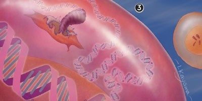 Chromosomal Instability Drives Cancer Metastasis | The Scientist