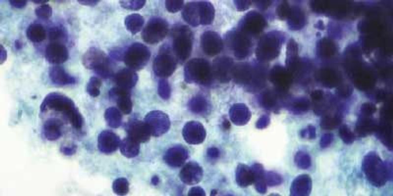 Mutant RAS Proteins Team Up for Oncogenicity | The Scientist