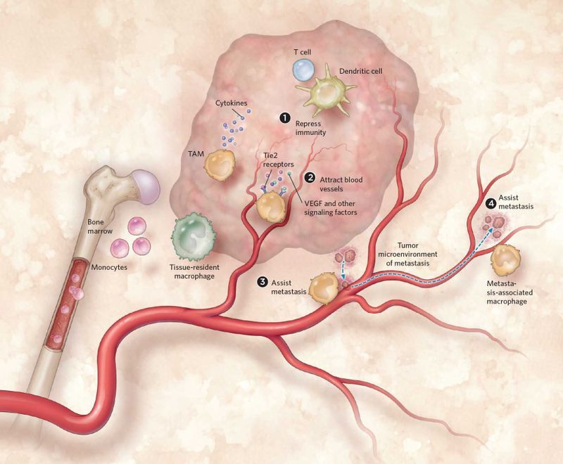 Infographic: Tumor-Associated Macrophages and Cancer | The Scientist