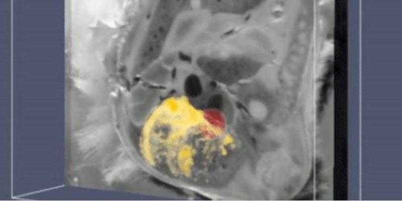 Image of the Day: Infection Imaging | The Scientist