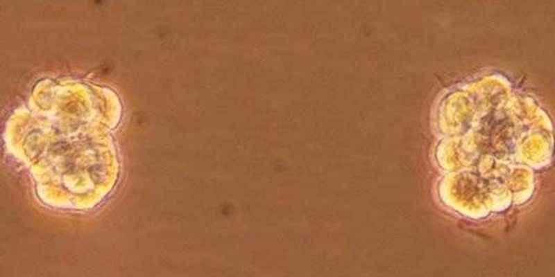 Image of the Day: Aging Brain Cells | The Scientist