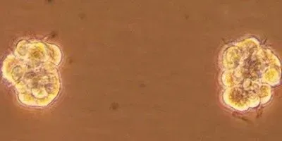 Image of the Day: Aging Brain Cells | The Scientist