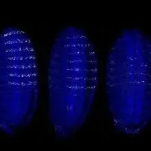 Image of the Day: Gene Expression | The Scientist