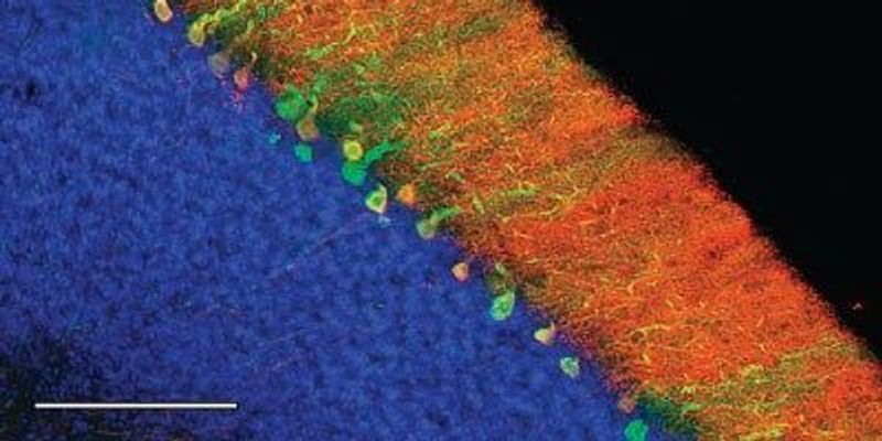 Lighting Up Monkey Brains | The Scientist