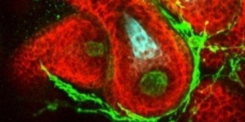 Image of the Day: Hair Follicles | The Scientist