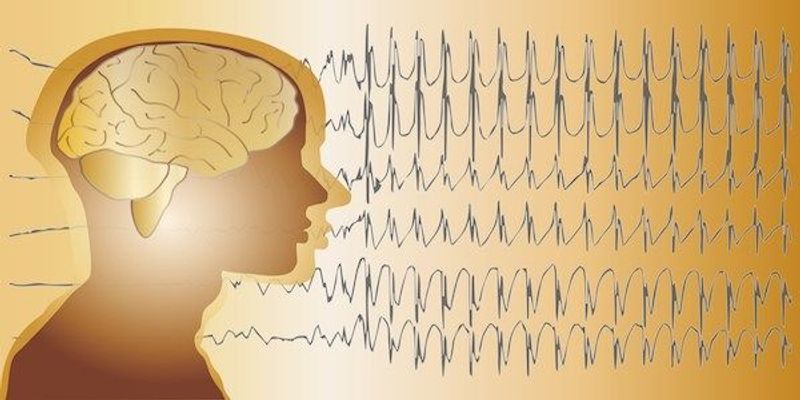 Long-Term Brain Rhythms Offer Possibility of Predicting Seizures | The ...