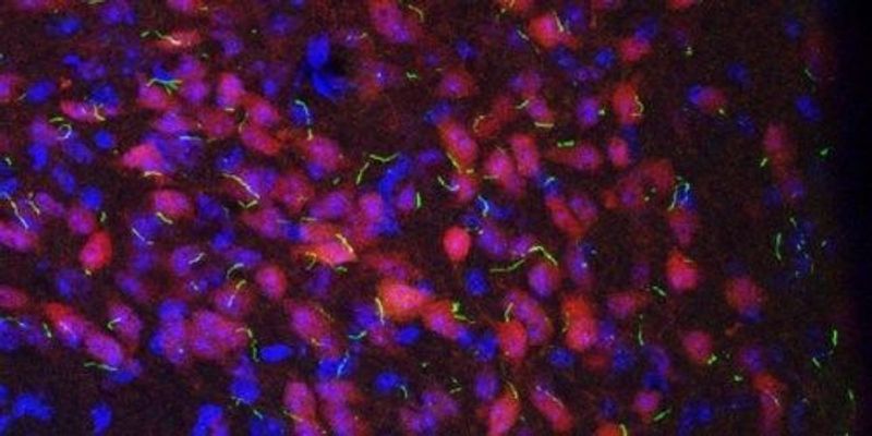 Primary Cilia in Neurons Linked to Obesity | The Scientist