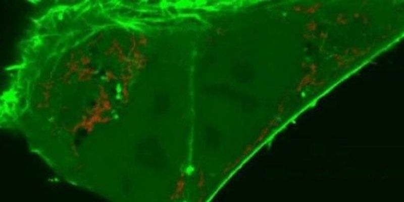 Image of the Day: Actin Burst | The Scientist