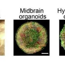 New and Improved Organoids Better Resemble Human Brains | The Scientist