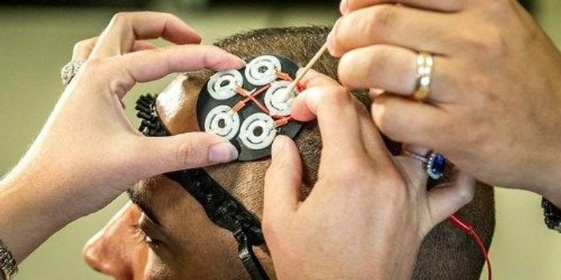 Study Raises Questions About Brain Stimulation Boosting Memory | The ...