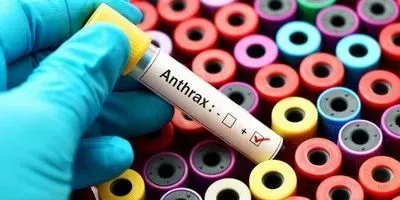 Report: Security Lapses in Handling of Deadly Pathogens | The Scientist