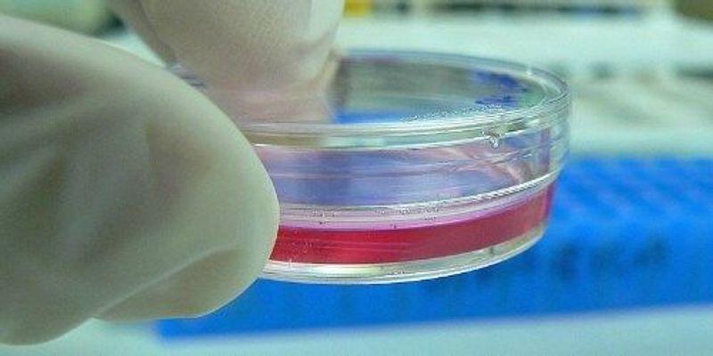 Papers Based on Misidentified Cell Lines Top 32,000 | The Scientist