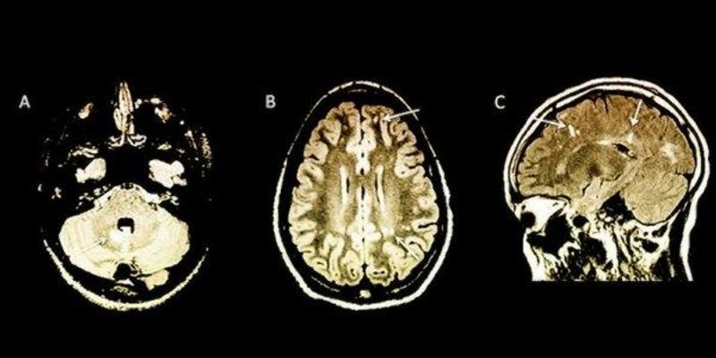 Image of the Day: Telling Scans | The Scientist