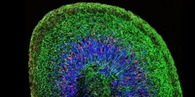 Image of the Day: Lab-Grown Brain | The Scientist