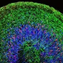 Image of the Day: Lab-Grown Brain | The Scientist