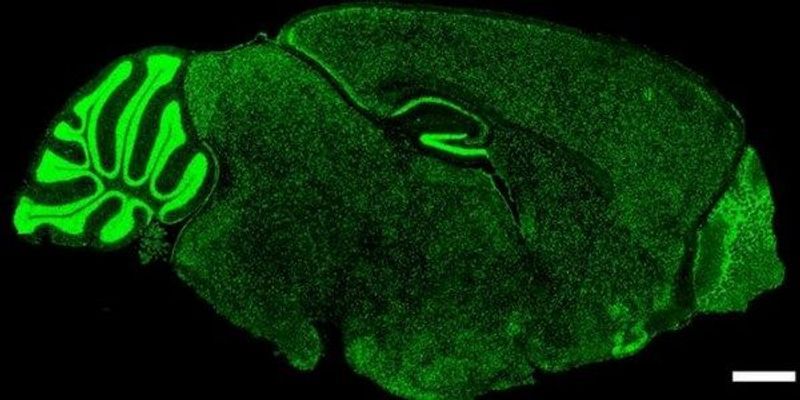 Image of the Day: Fragile Brain | The Scientist