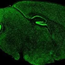 Image of the Day: Fragile Brain | The Scientist