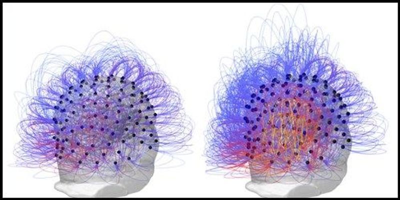 Nerve Stimulation Revives Consciousness from Vegetative State | The ...