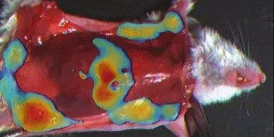 Image of the Day: Infrared Tumors | The Scientist