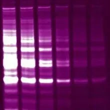 Mix-n-Stain™ Total Protein Prestain Kits | The Scientist