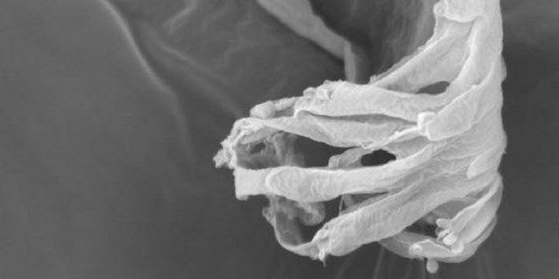 Image of the Day: Mouth Parts | The Scientist