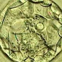 CRISPR Used in Human Embryos to Probe Gene Function | The Scientist