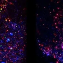 Image of the Day: When Cells Stop Cleaning | The Scientist
