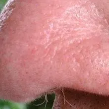 Booger Bacteria’s Sweet Immune Suppression | The Scientist