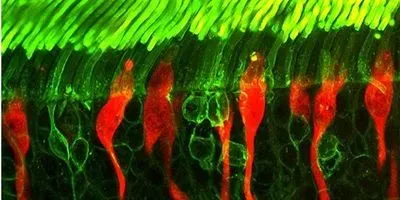 What the Sun Does to Photoreceptors | The Scientist
