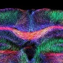 Nerve Fibers | The Scientist