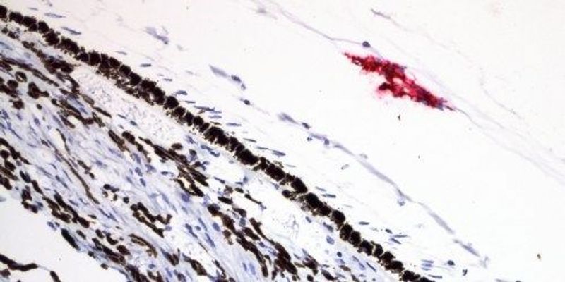 Ebola Persistence Documented in Monkeys | The Scientist