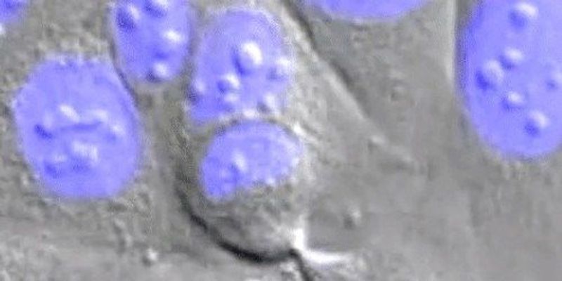 Cell Cannibalism as Cancer Defense | The Scientist