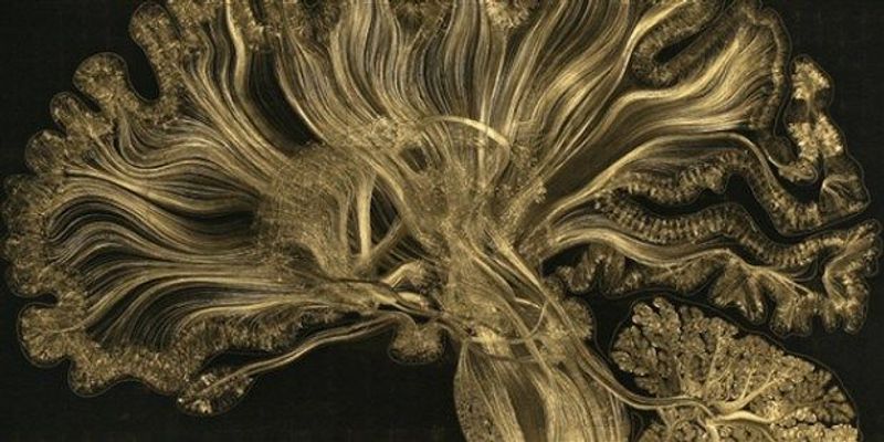 Image of the Day: Gold Matter | The Scientist