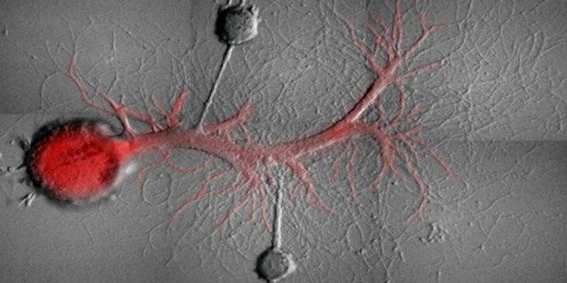 Memories Erased from Snail Neurons | The Scientist