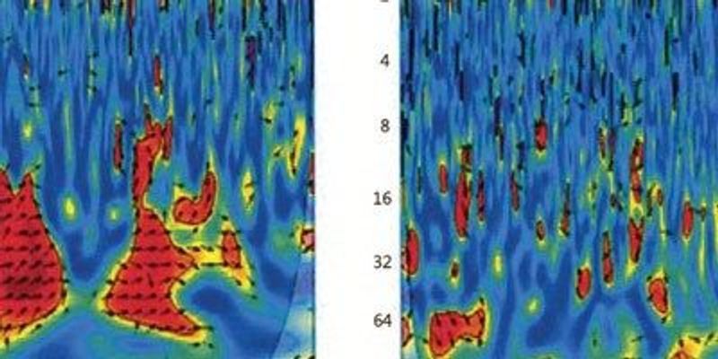 The Search for Methods to Monitor Brain Cooling | The Scientist