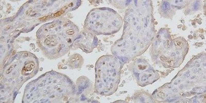 Study Bucks Belief that Oxidative Stress Is Bad for Pregnancy | The ...