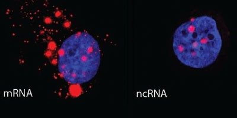 Noncoding RNA Helps Cells Recover from DNA Damage | The Scientist