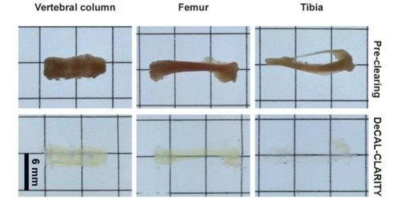 Tissue-Clearing Technique Works on Bone | The Scientist