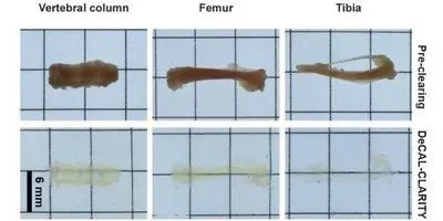 Tissue-Clearing Technique Works on Bone | The Scientist