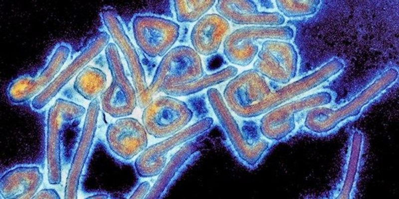 Image of the Day: Fighting Filoviruses | The Scientist Magazine®