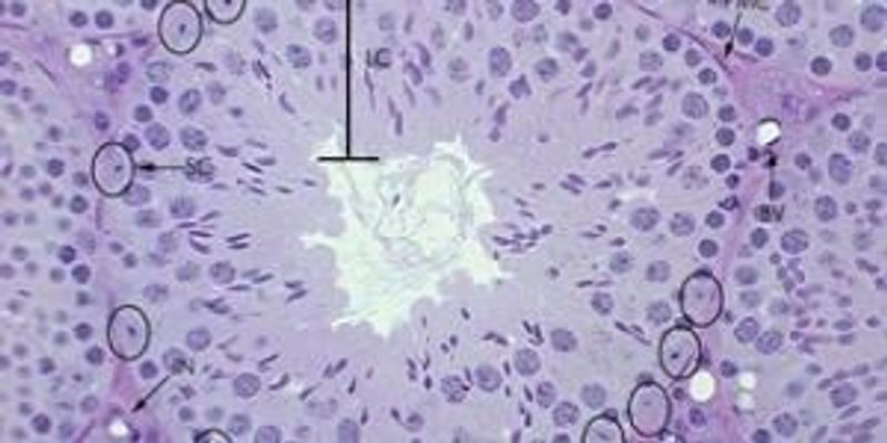 Study: Zika Shrinks Testicular Tissue in Mice | The Scientist