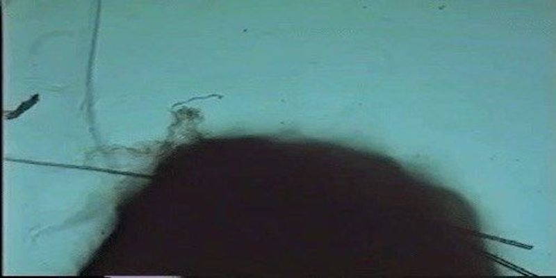 Image of the Day: Seizure-Inducing Worms | The Scientist