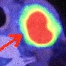 Lipids | The Scientist