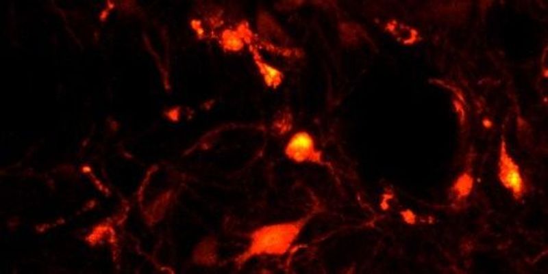 Researchers Pinpoint Neurons Behind Sleep Paralysis in Rats | The Scientist