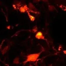 Researchers Pinpoint Neurons Behind Sleep Paralysis in Rats | The Scientist