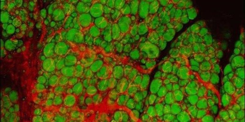 Image of the Day: Good Fat, Bad Fat | The Scientist