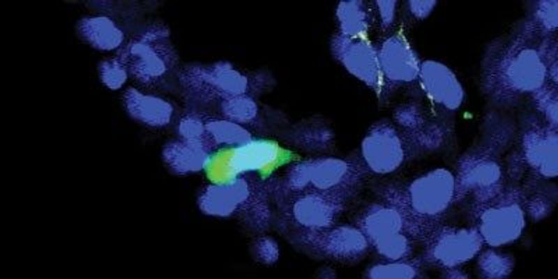 How To Track Cell Lineages As They Develop The Scientist Magazine how-to-track-cell-lineages-as-they-develop-the-scientist-magazine