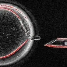 Three-Parent IVF Advances | The Scientist