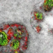 Electron Micrographs Get a Dash of Color | The Scientist